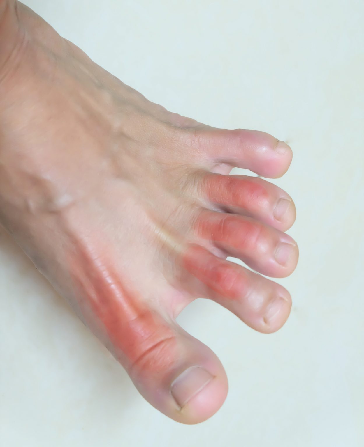 Putika – Vse in še več o izdelkih